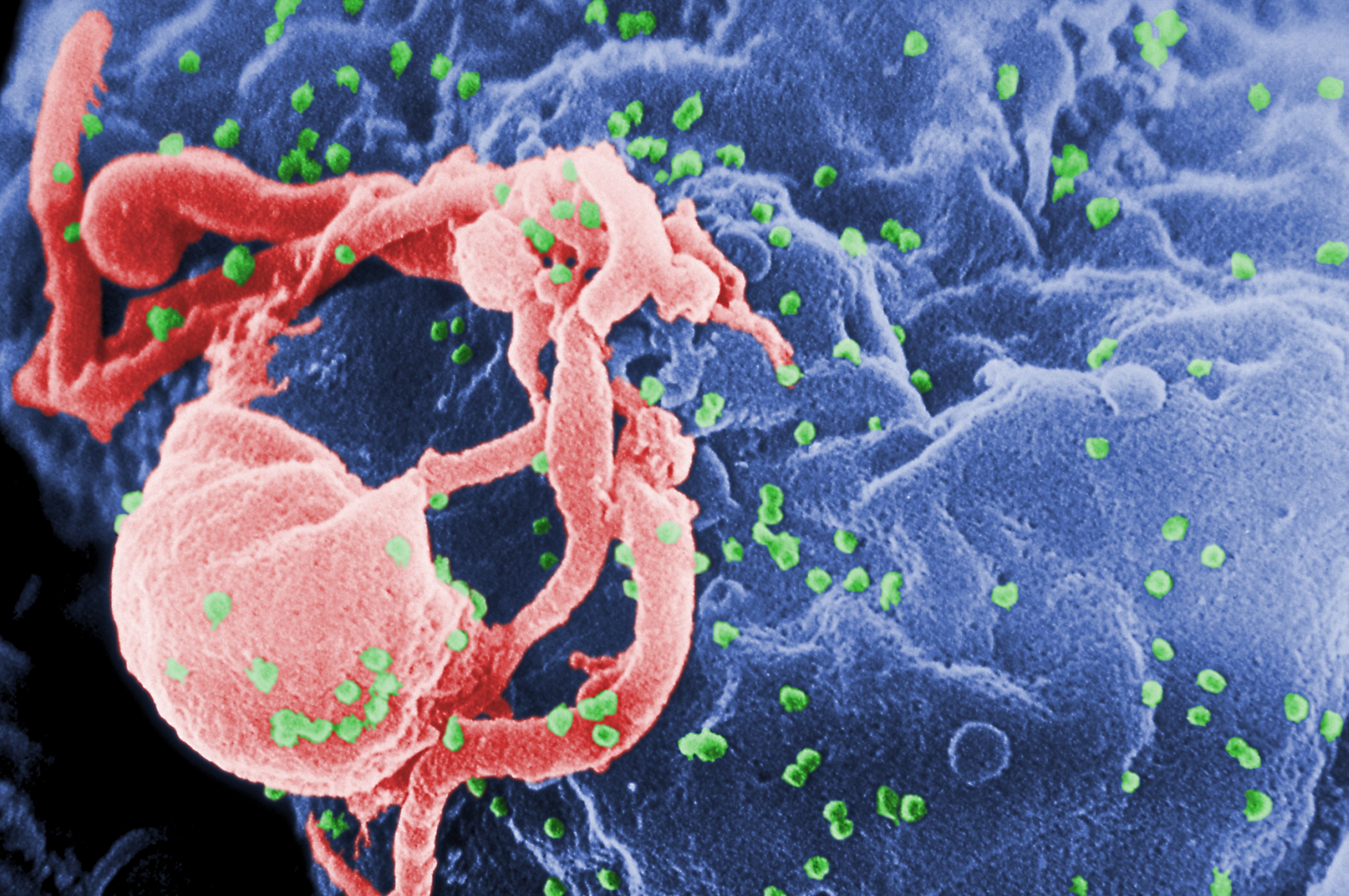 HIV Cure 2019: Is HIV curable now?