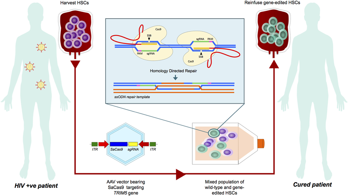 Groundbreaking new cure for HIV/AIDS found in immunotherapy