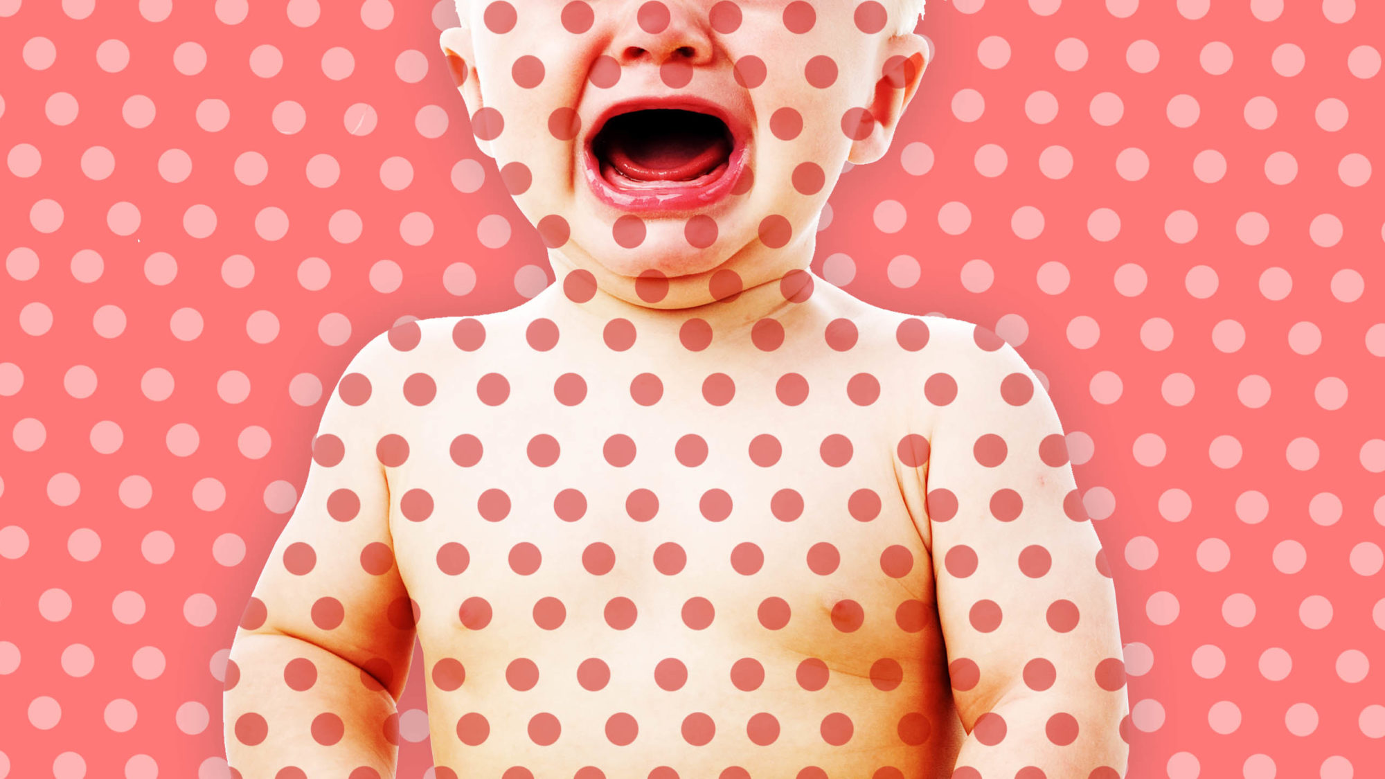 Measles outbreak 2019: Battling measles in summer camp newest challenge ...
