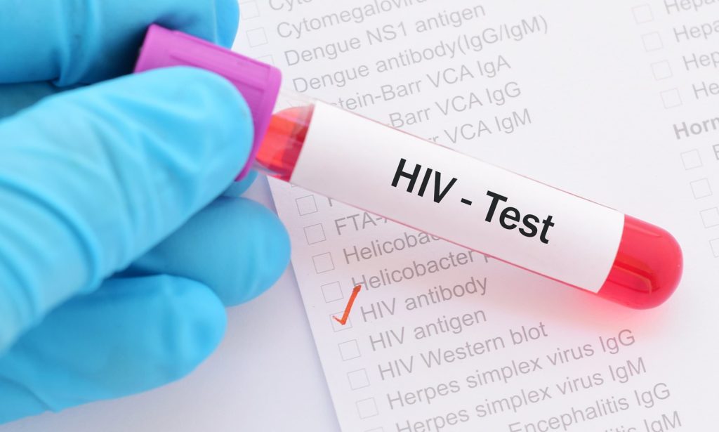 Cure for HIV/AIDS: Early Diagnosis can Prevent Late Stage HIV and Stop AIDS