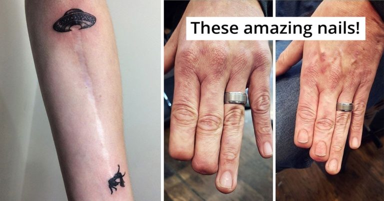 20+ People Who Brilliantly Covered Up Their Birthmarks And Scars With ...