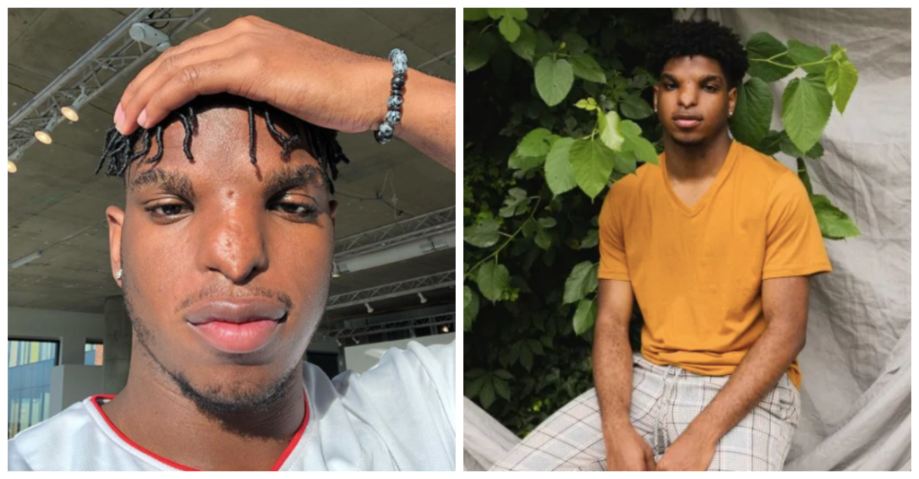 Teenager who was bullied because of his disfigured nose becomes top model