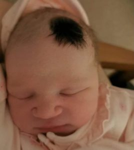 Why Some Babies Have Hair and Some Don’t