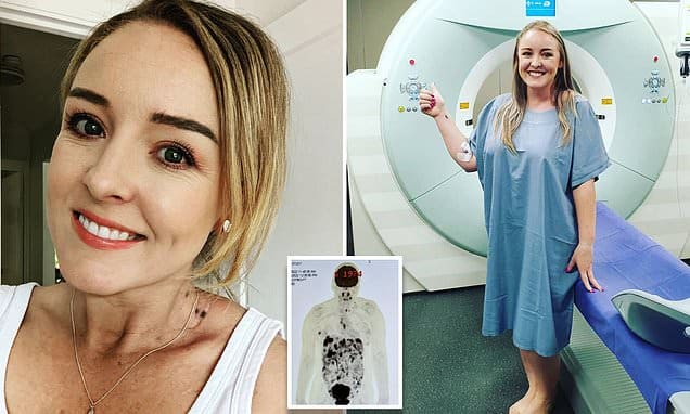 Woman Gets Diagnosed With Terminal Skin Cancer After Noticing a Tiny ...