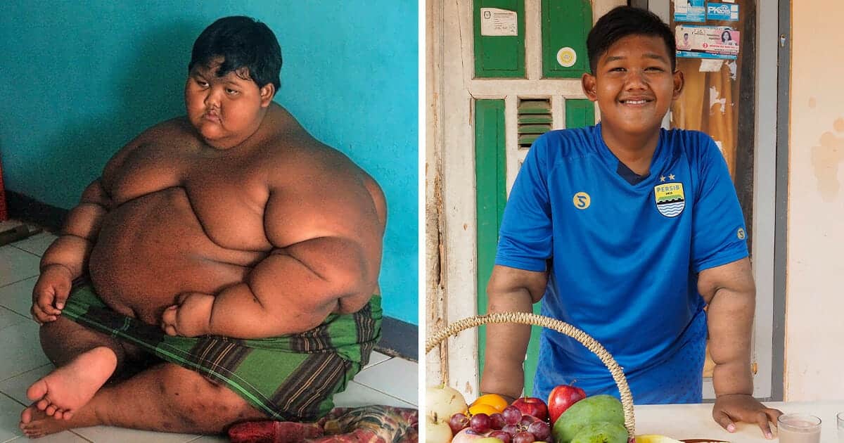 Once Called World s Heaviest Kid Boy Now Proves That There Is No Once Called World s Heaviest Kid Boy Now Proves That There Is No