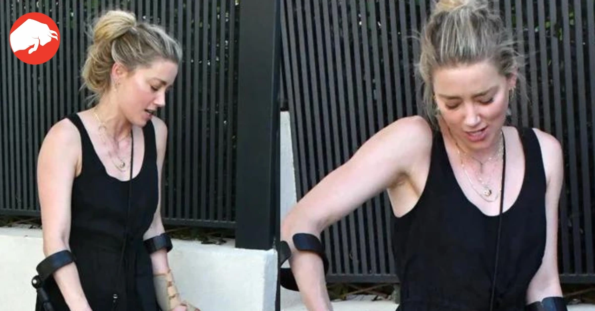 Amber Heard Continues to Use a Crutch After Suffering a Hip Injury ...
